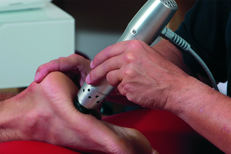 Shockwave Treatment in Sports Medicine - Southgate Physio London